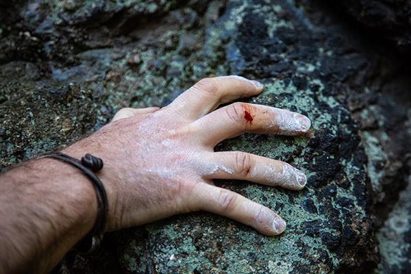Accelerating Recovery: How CBD Can Aid Climbers in Overcoming Finger I ...